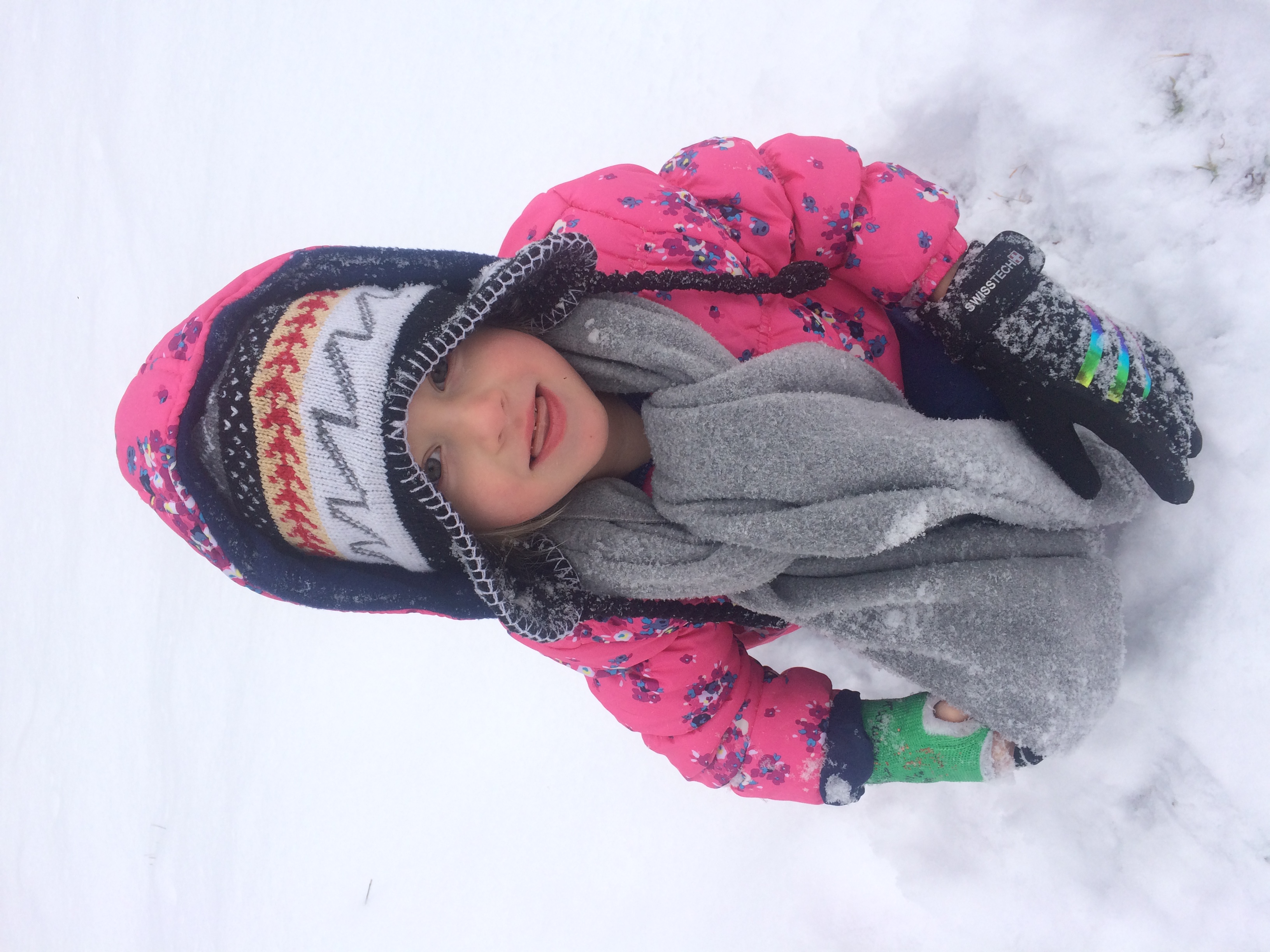 Help! My Kid is in a Cast! - The Glorious Mundane